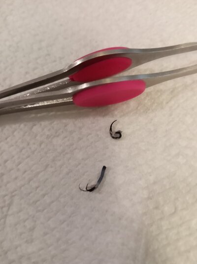 Ingrown Feather? | BackYard Chickens - Learn How to Raise Chickens