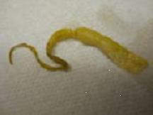 THIS just came out of my chicken's cloaca. | BackYard Chickens - Learn ...